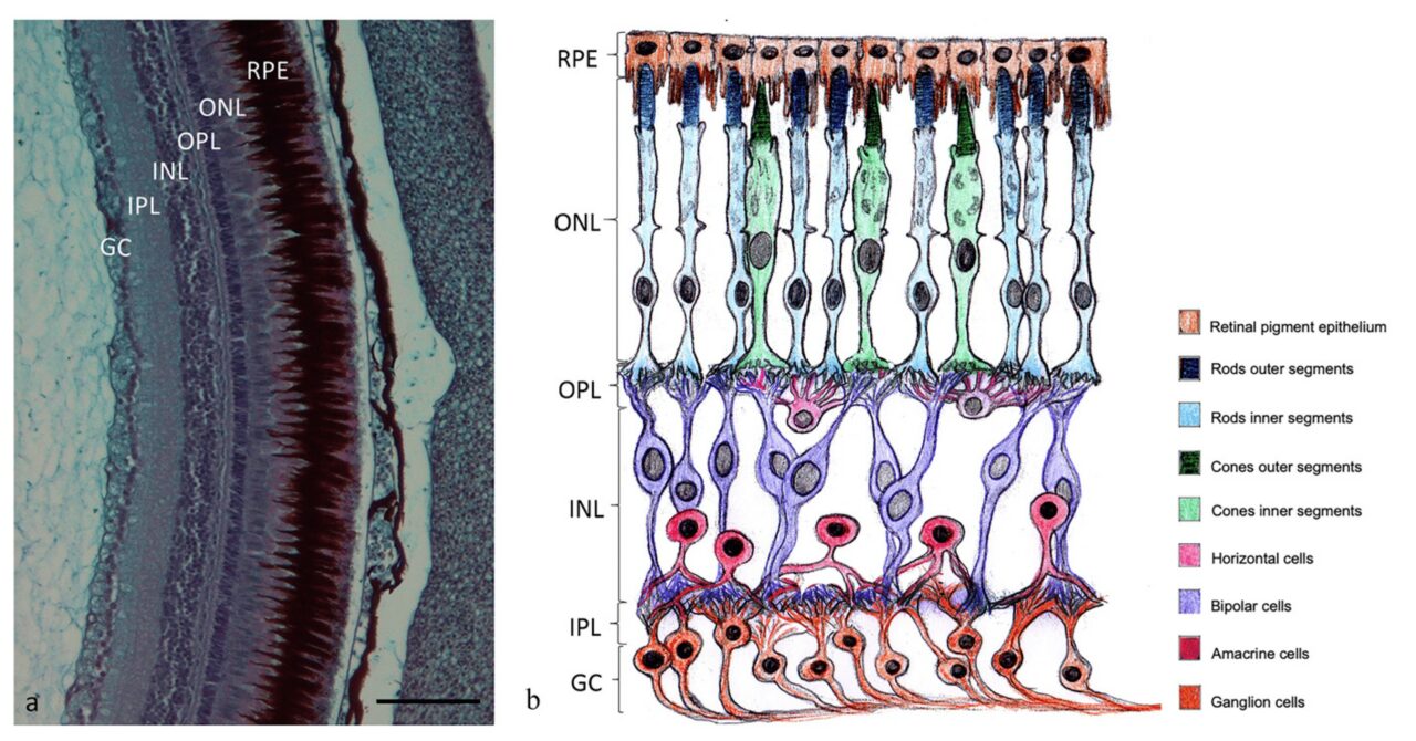 Potential Neuroprotective Role of Calretinin-N18 and Calbindin-D28k in ...