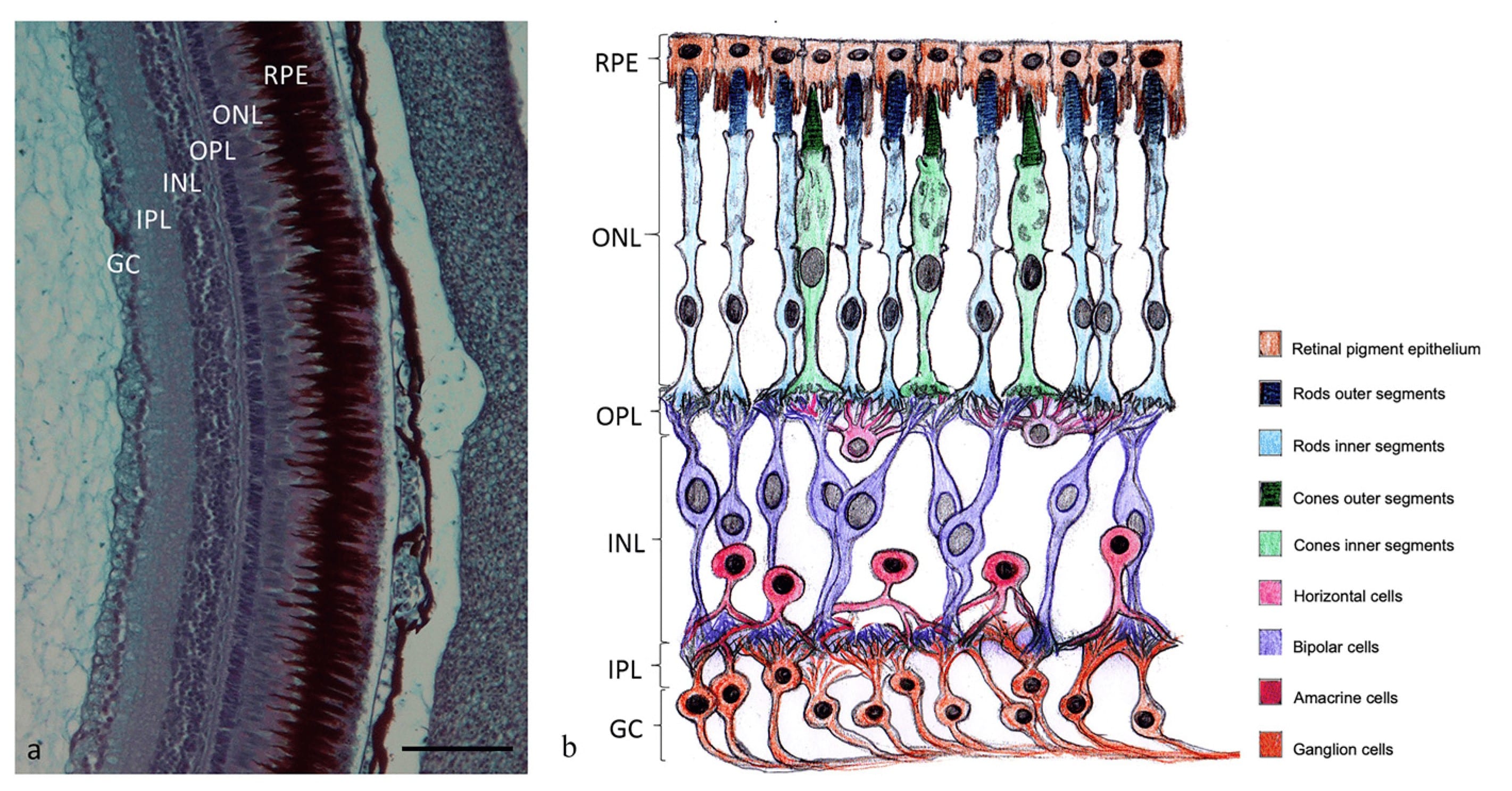 Potential Neuroprotective Role of Calretinin-N18 and Calbindin-D28k in ...