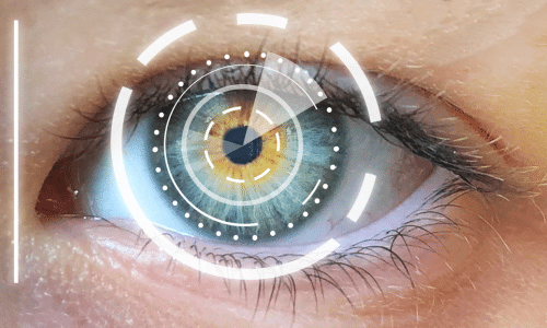 Visual Quality, Motility Behavior, and Retinal Changes Associated with ...